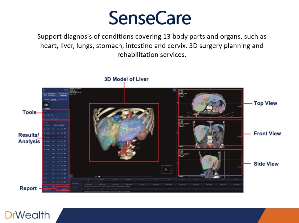 SenseTime IPO: Is it worth the investment?
